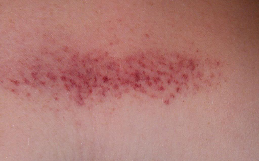 Upgraded Glutathione Archives - Fix Your Gut